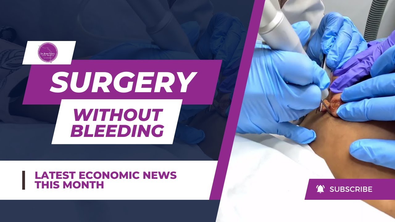 Surgery Without Bleeding - YouTube