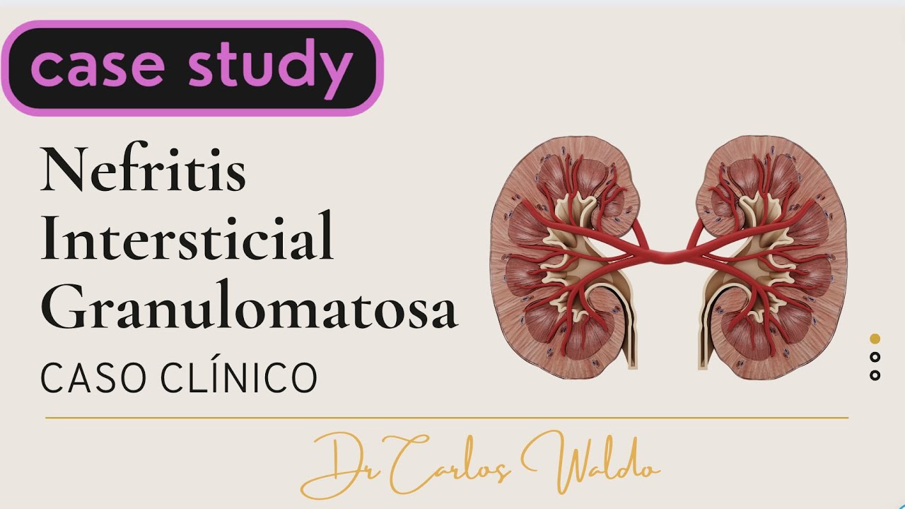 NEFRITIS INTERSTICIAL GRANULOMATOSA Caso clínico - YouTube