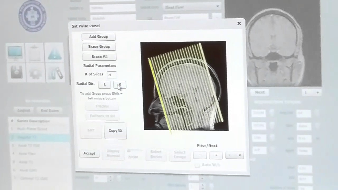 MRI Brain (simulation) -06- - YouTube