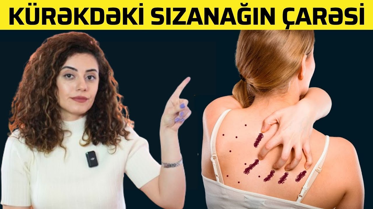 Kürəkdə SIZANAQ Nədən Yaranır? ÇARƏSİ ÇOX SADƏDİR... - YouTube