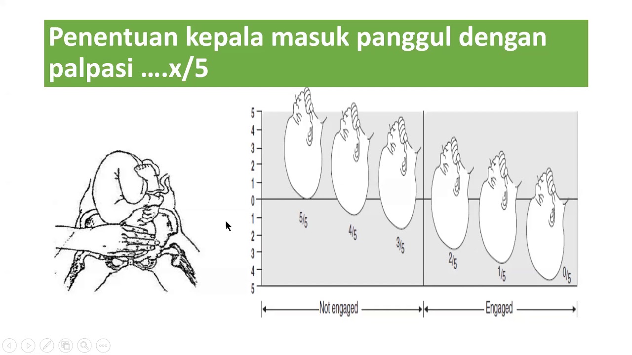 Kuliah Pengantar Skills 2 Partus normal termasuk masa nifas dr ...
