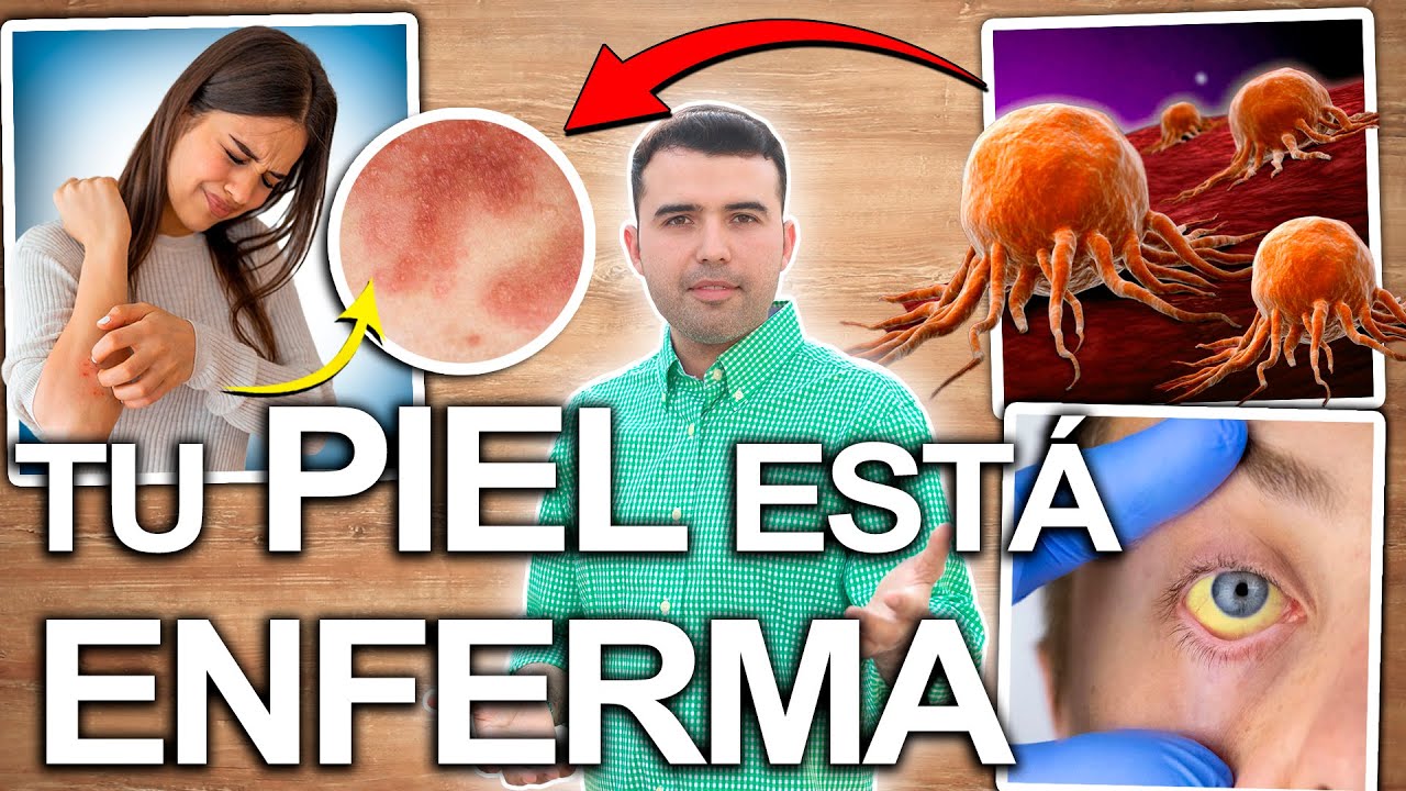 TU PIEL TE ESTA ALERTANDO! - Signos Y Síntomas En La Piel Que Indican ...
