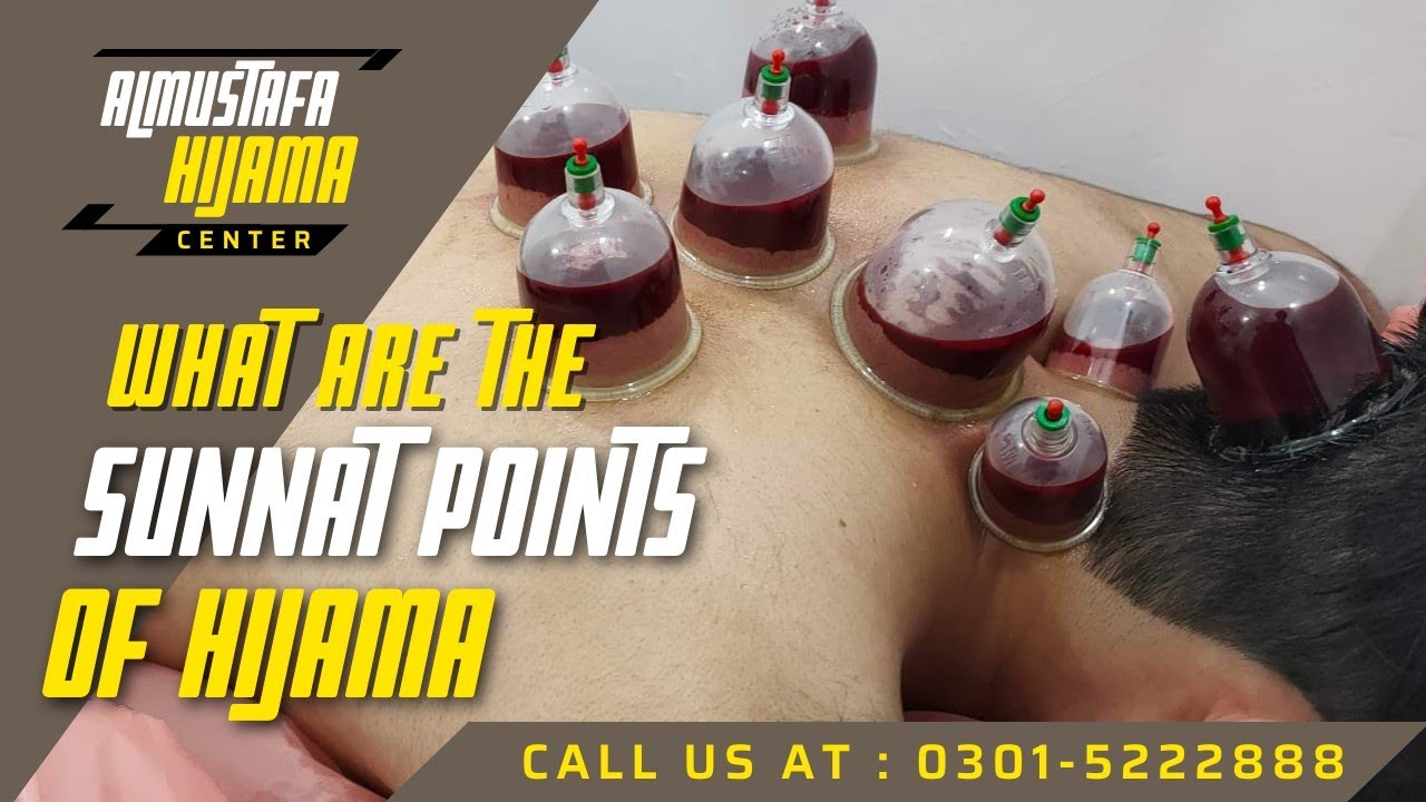 What are the SUNNAT Points of HIJAMA ? General session and Specialized ...