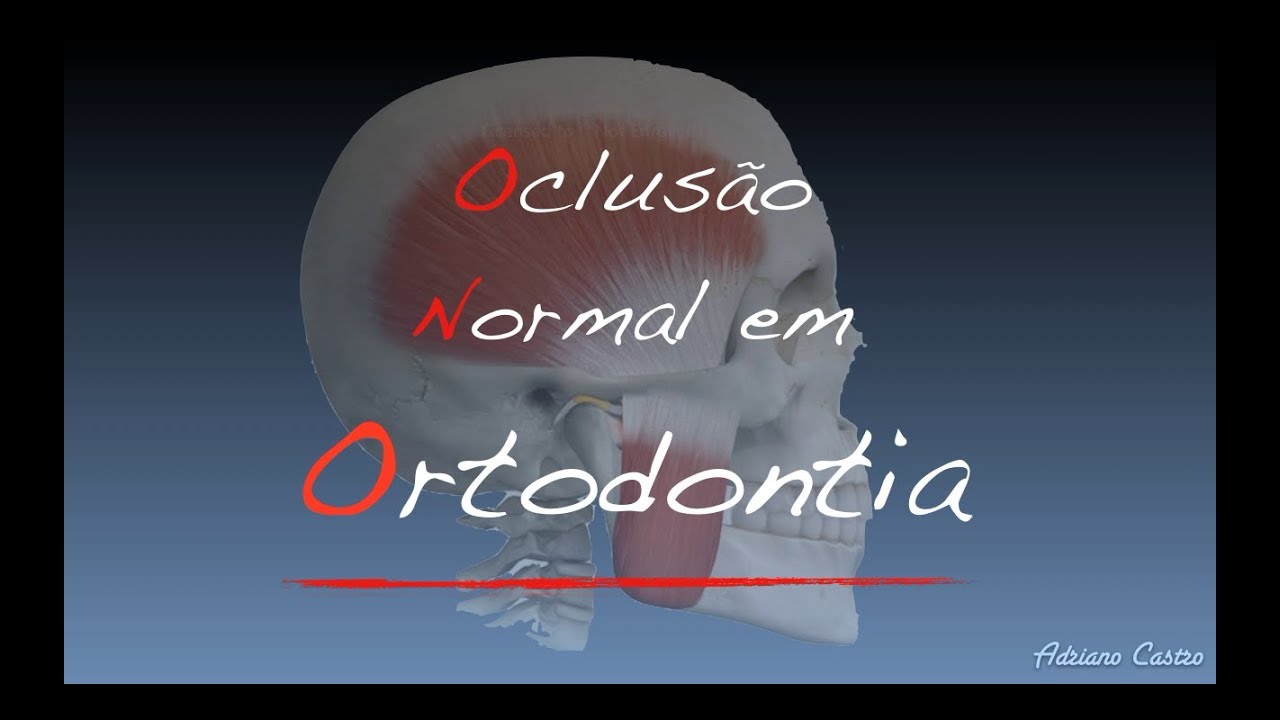 Oclusão Normal em Ortodontia - Prof. Dr. Adriano Castro - YouTube
