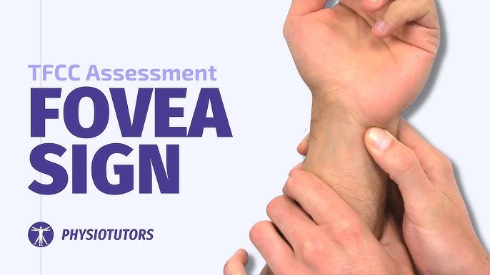 Tfcc Compression Test Triangular Fibrocartilage Complex 57 Off