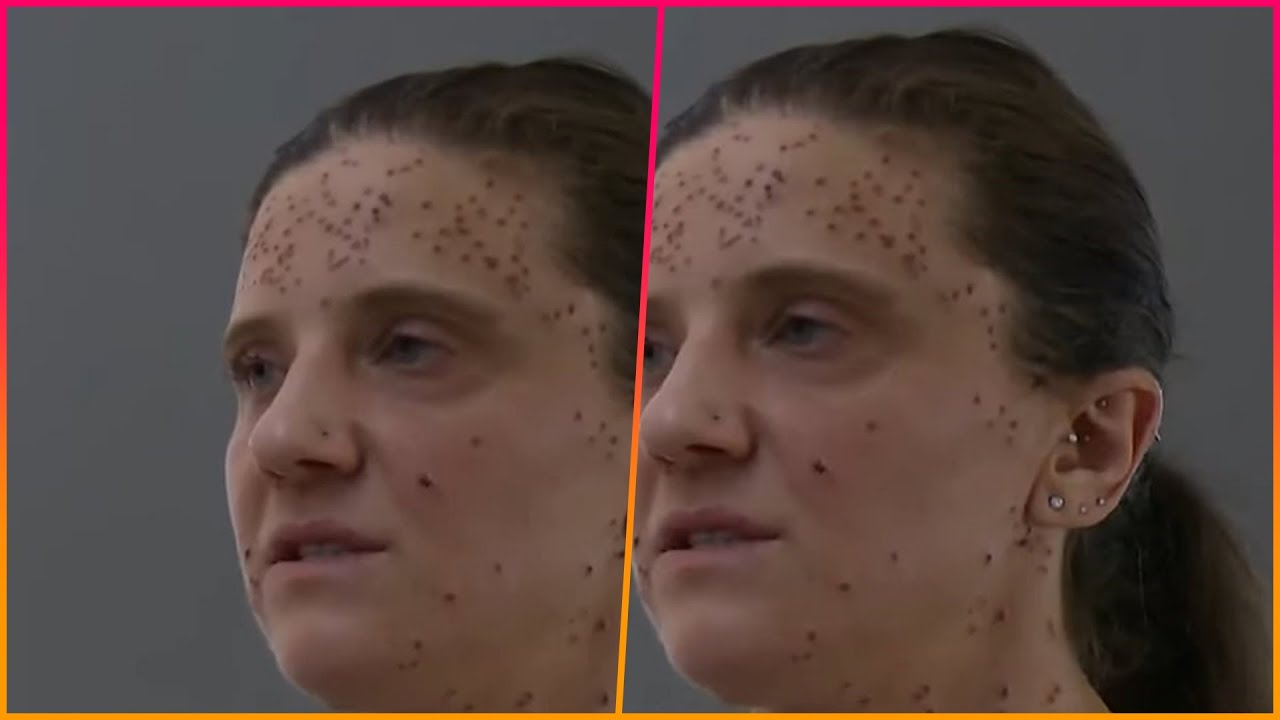 Disfigured California nurse says Southwest kicked her off flight for ...