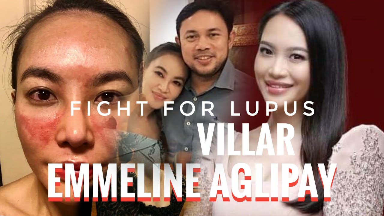 Mis. Villar| wife of Mark Villar winning for Lupus disease - YouTube
