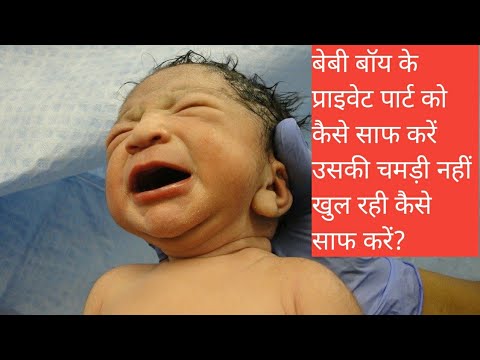 Baby boy के प्राइवेट पार्ट को साफ कैसे करें?How to clean baby boy ...