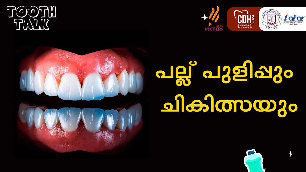 pallu pulippu chikilsalayam in malayalam - YouTube