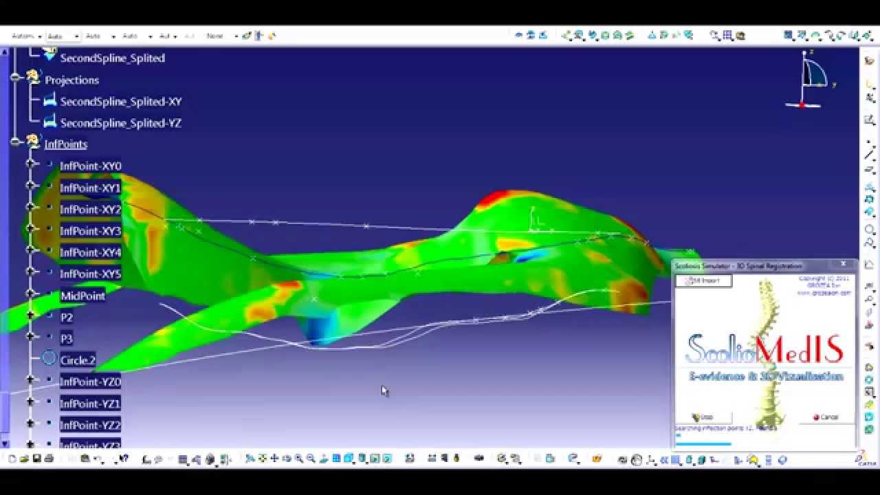 Catia V5 Scoliosis Simulator - YouTube