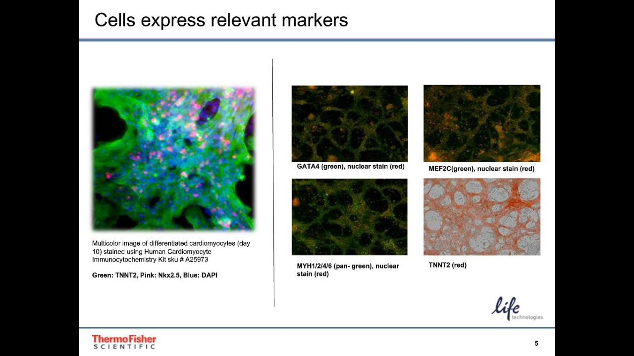PSC Cardiomyocyte Differentiation Kit – PSCs to cardiomyocytes in three ...