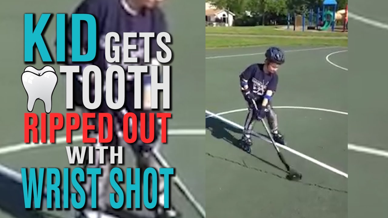 Kid gets tooth ripped out with wrist shot - YouTube