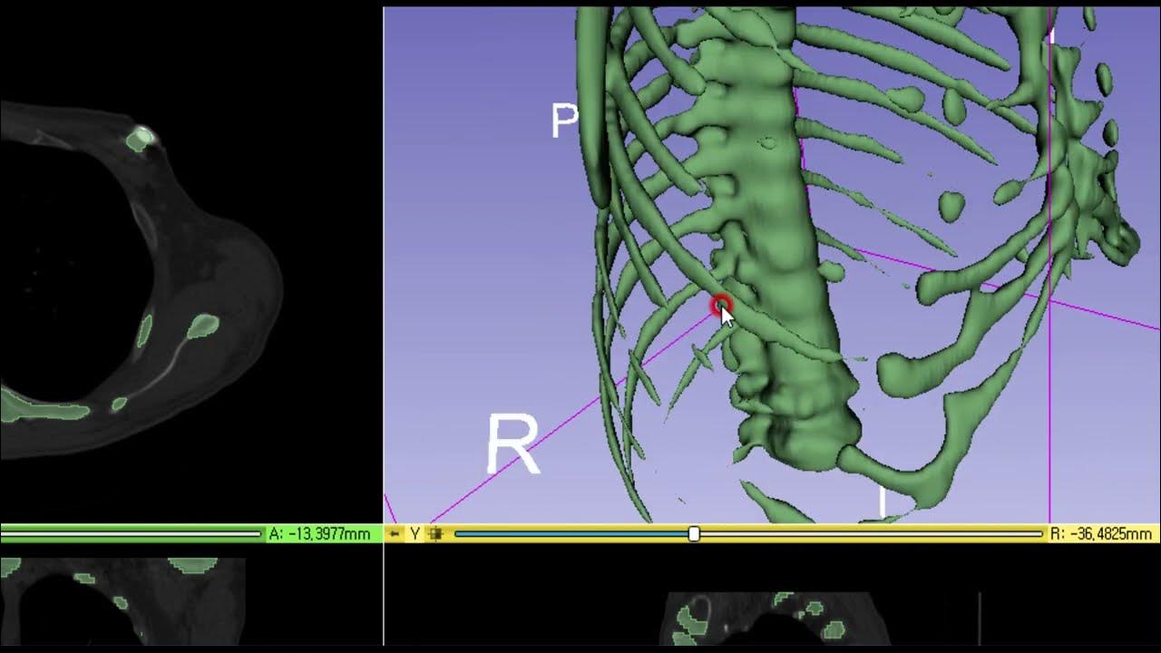 3D Slicer Editor Basic 5 - YouTube