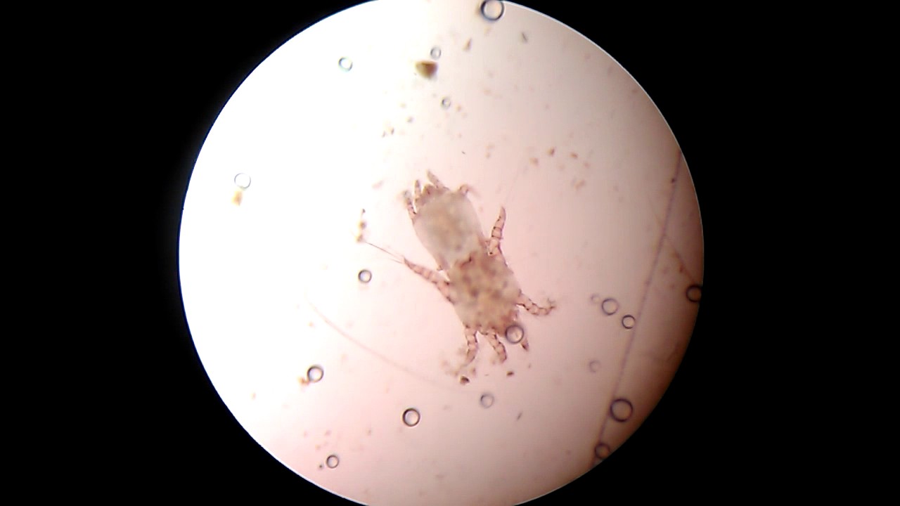 Mating in Mites - YouTube