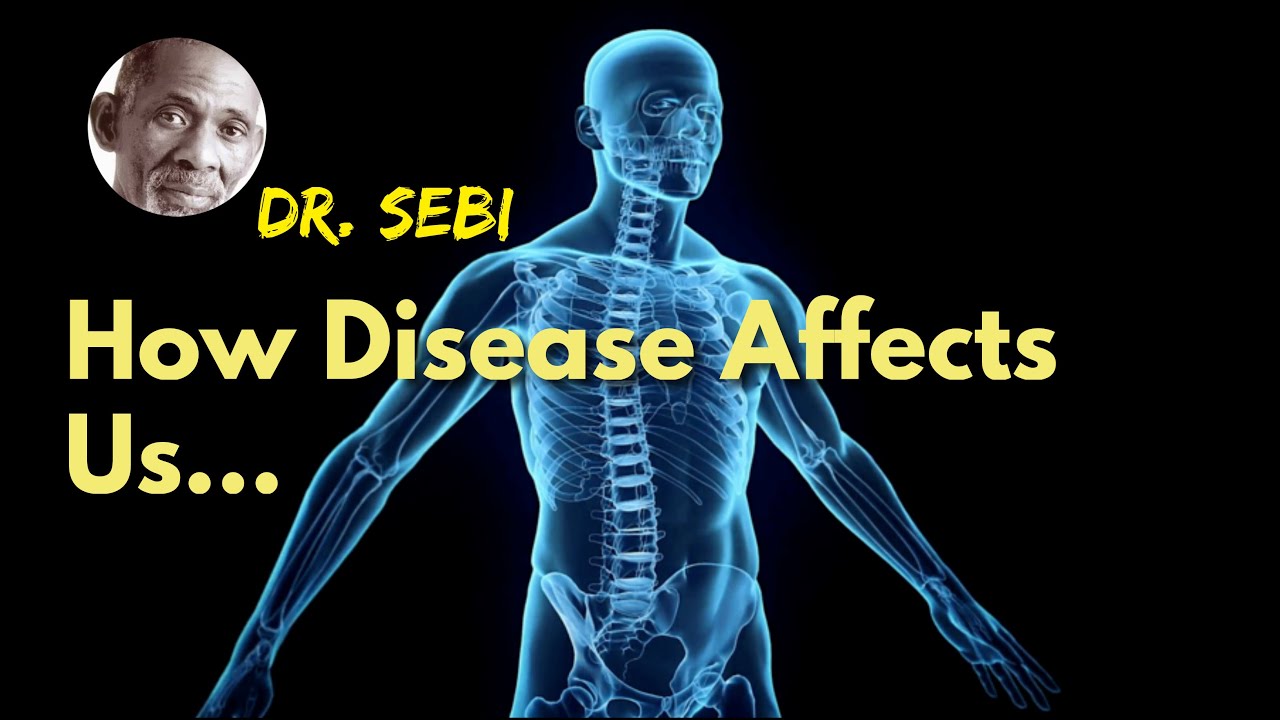 Dr. Sebi on WHAT DISEASE DOES TO US #drsebi #disease - YouTube