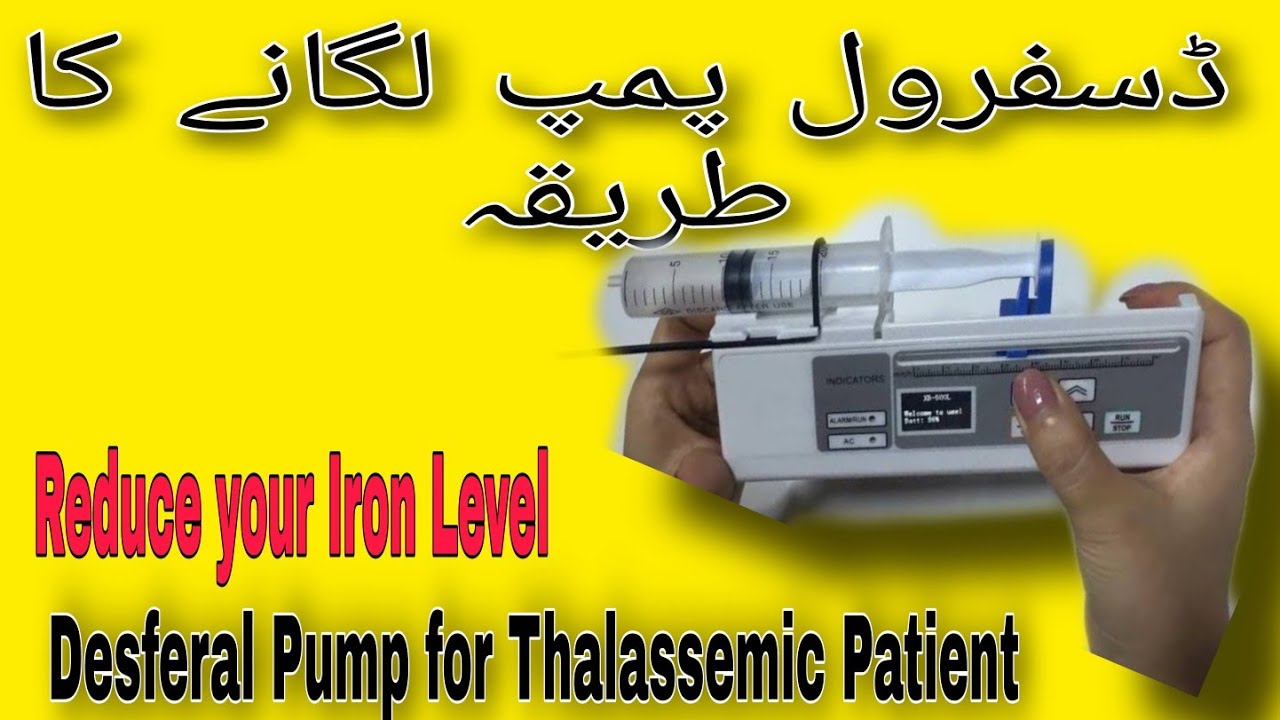 Iron chelation / How do you use a Desferol pump? - YouTube