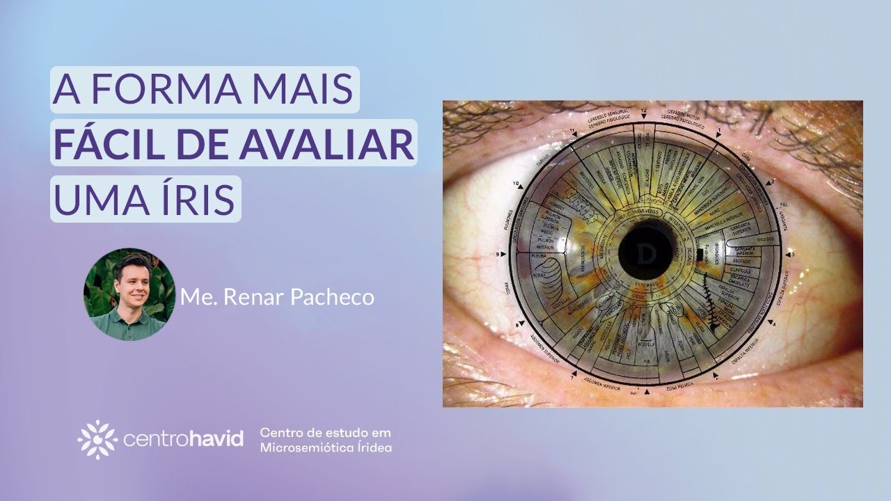 Análise de íris ao vivo com paciente I Os blocos de uma avaliação # ...