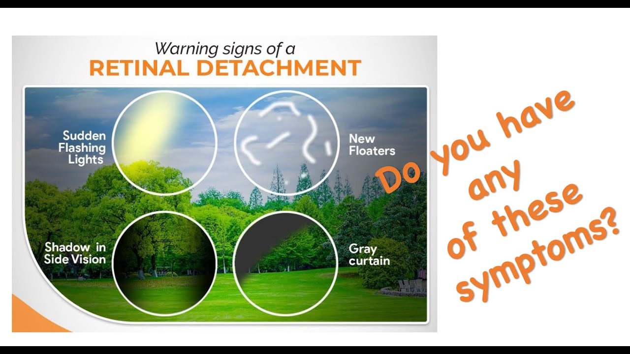 Retinal Detachment: Symptoms and Treatment - YouTube