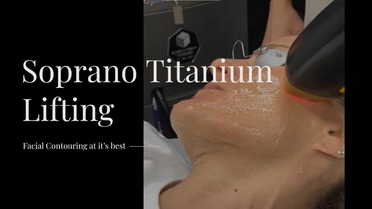Soprano Titanium Lifting - Facial Contouring at it’s best! - YouTube