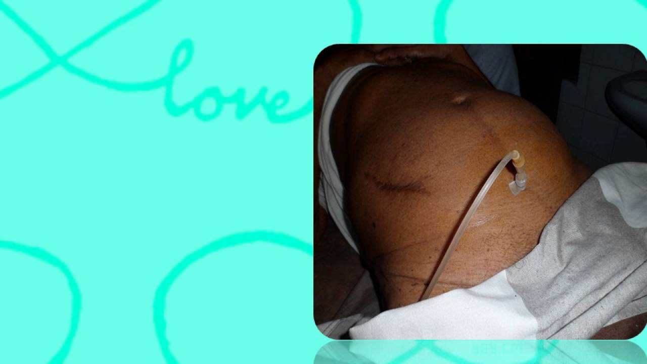 Urology Procedure YouTube
