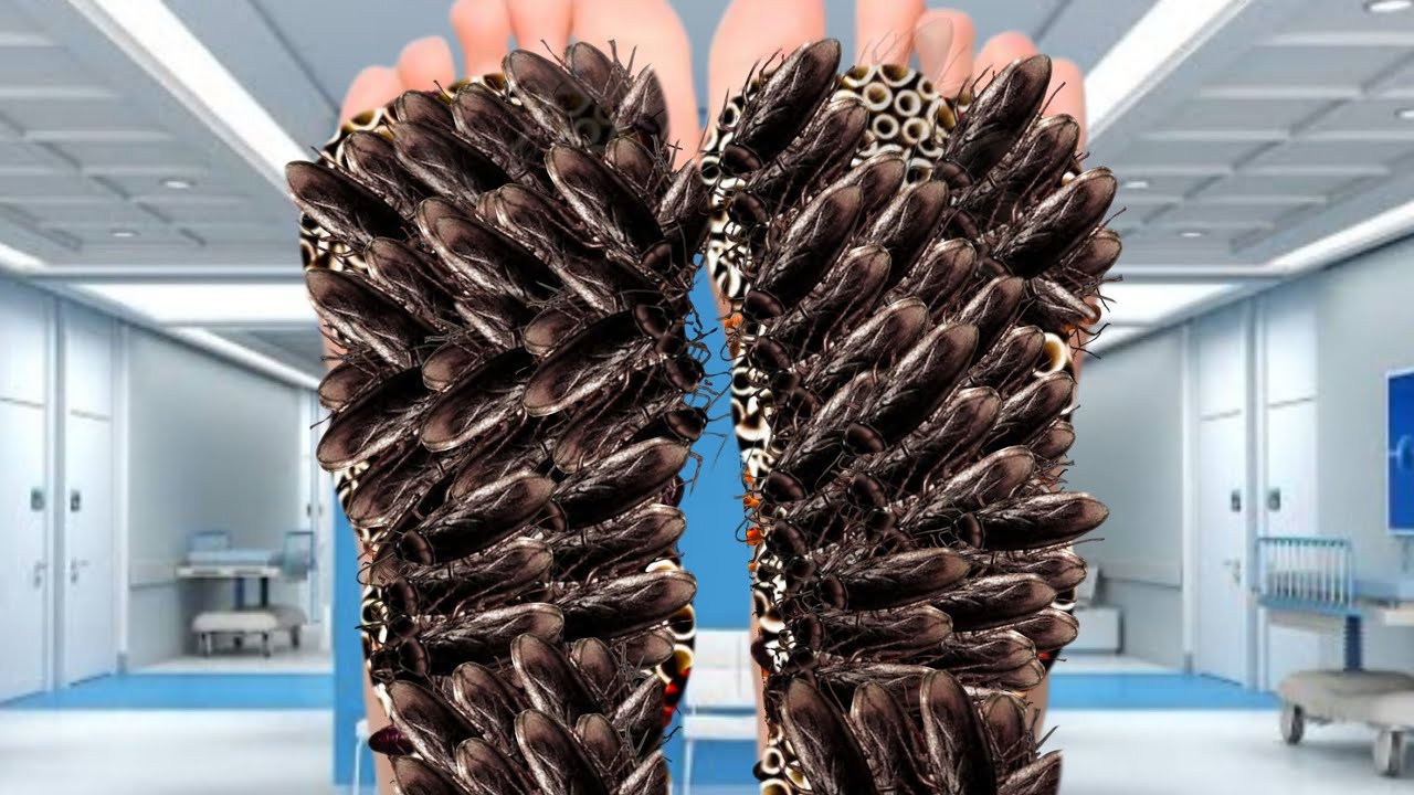 Asmr | Feet cleaning calm animation | remove bugs from both of feets ...