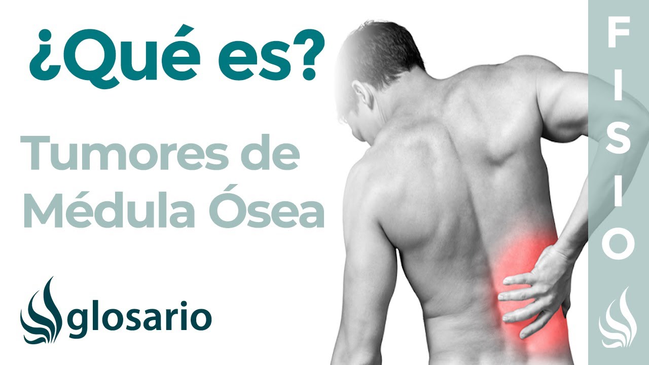 TUMORES de MÉDULA ÓSEA| Qué es, qué estructuras afecta, síntomas ...