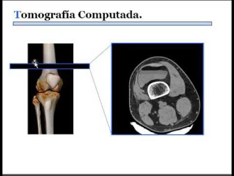 introduccion a los metodos de diagnostico por imagen TC - YouTube