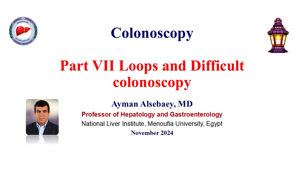 Colonoscopy Part VII Loops and difficult colonoscopy 2024 - YouTube
