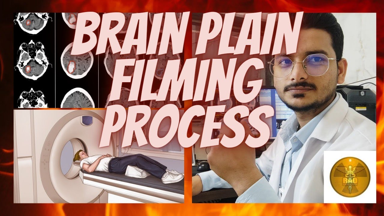 CT SCAN Brain plain filming process || #ctscan #radiologytechnologist # ...
