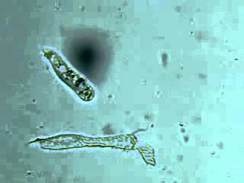 Limax amoebae - YouTube