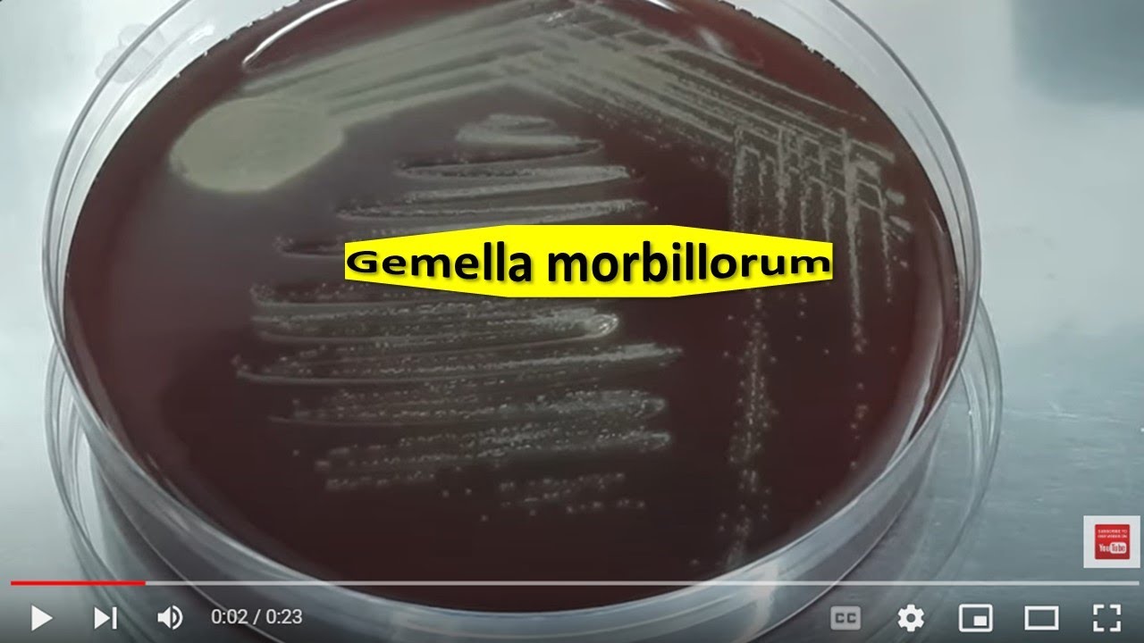 Gemella Colony Morphology on Blood Agar - YouTube