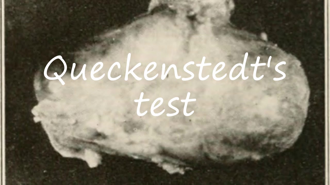 How to Pronounce Queckenstedt's test? - YouTube