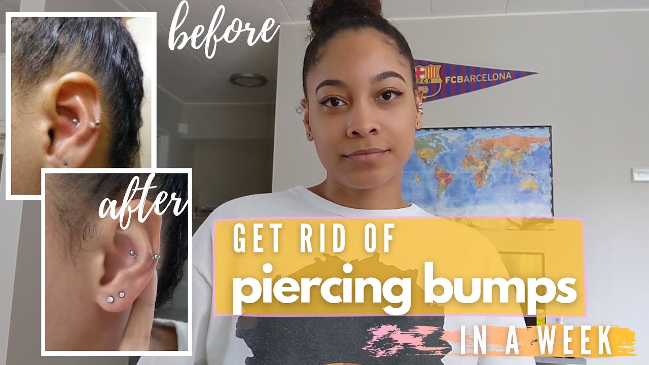 HOW TO GET RID OF PIERCING BUMPS (IN A WEEK) - YouTube