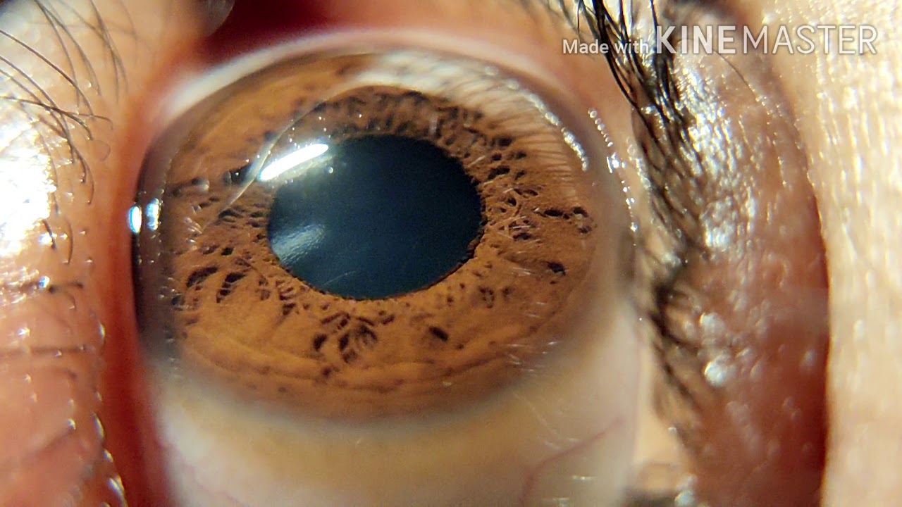 Micro lens amazing shot #op - YouTube