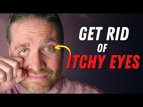 Which Pills Combat Itchy Eyes