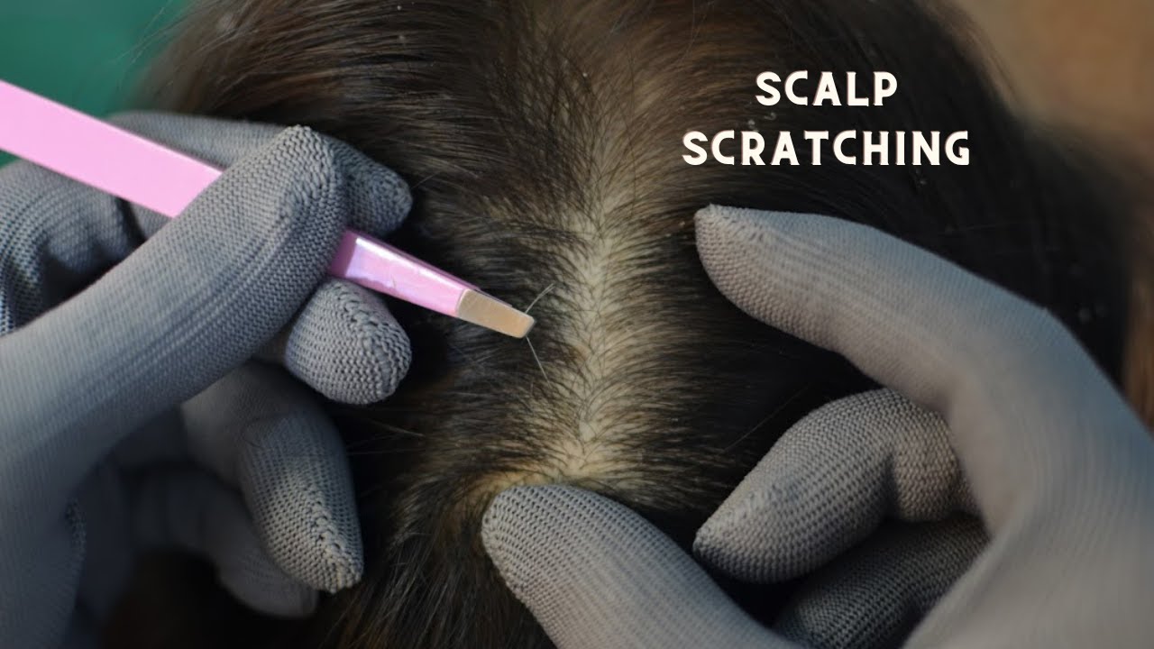 ASMR Scalp Check Real Person, Scalp Scratching, Scalp Picking, Plucking ...