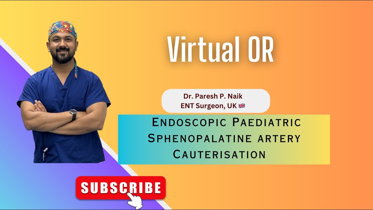 How to do Endoscopic Paediatric Sphenopalatine Artery Cautery in ...