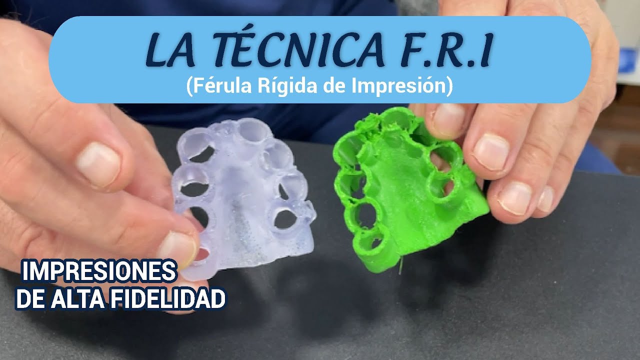 LA TÉCNICA F.R.I (Férula rígida de impresión) IMPRESIONES DE ALTA ...