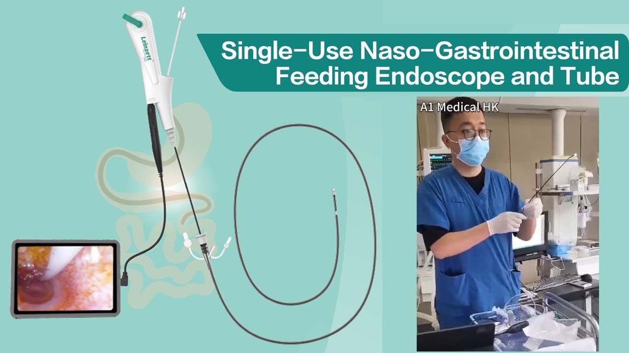 Feeding Scope placement of small intestine feeding tube (A1 Medical ...