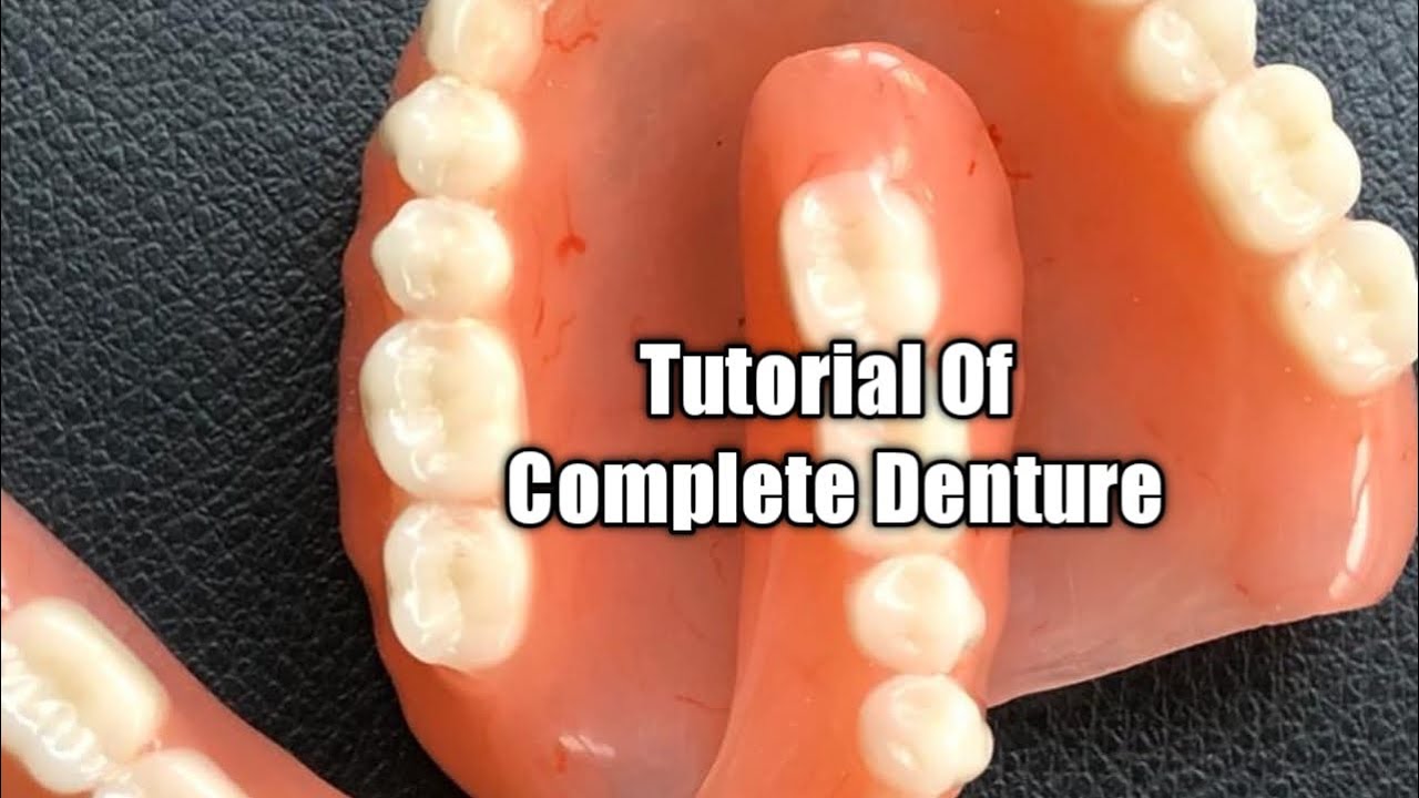 Complete Denture Fabrication - YouTube