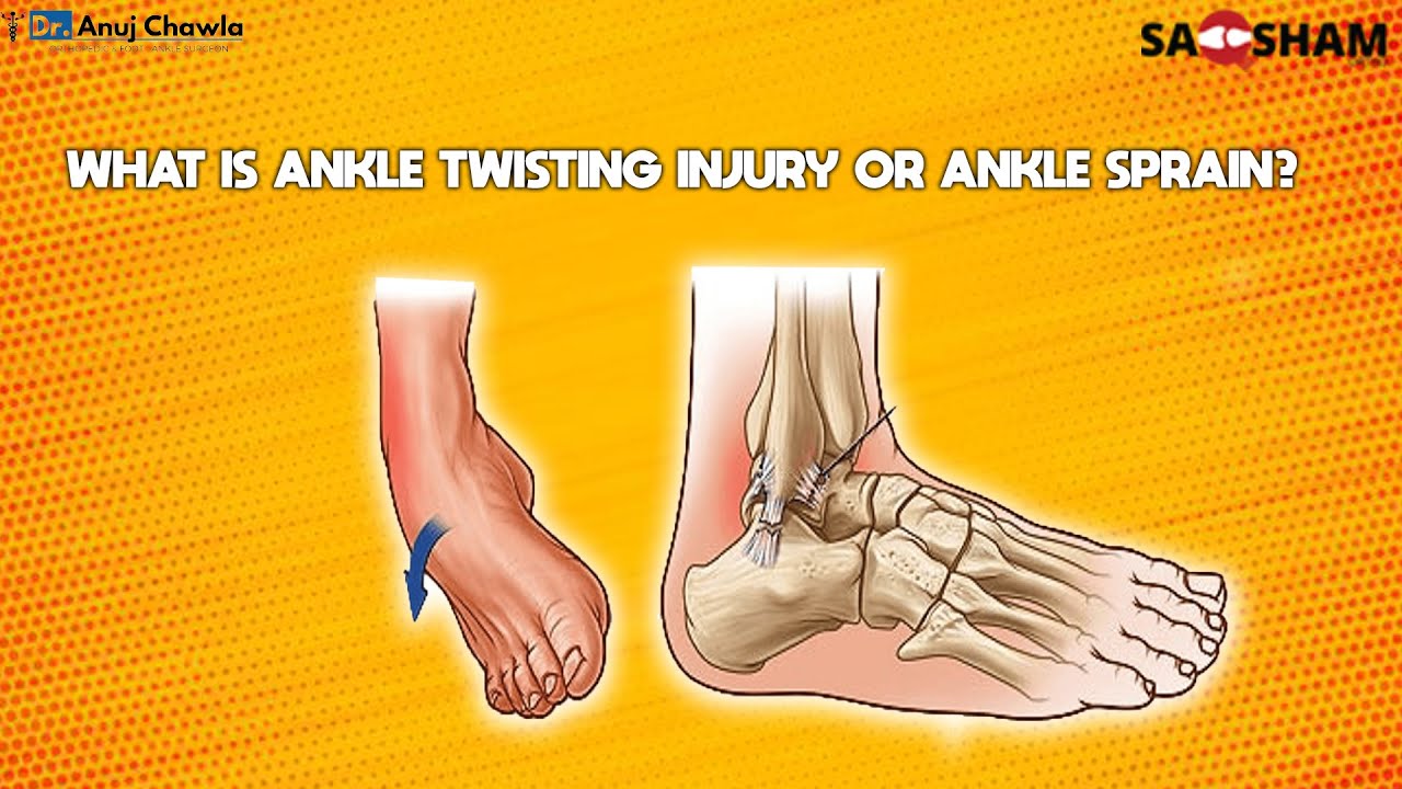 What is Ankle Twisting Injury or Ankle Sprain@saqshamortho1346 - YouTube