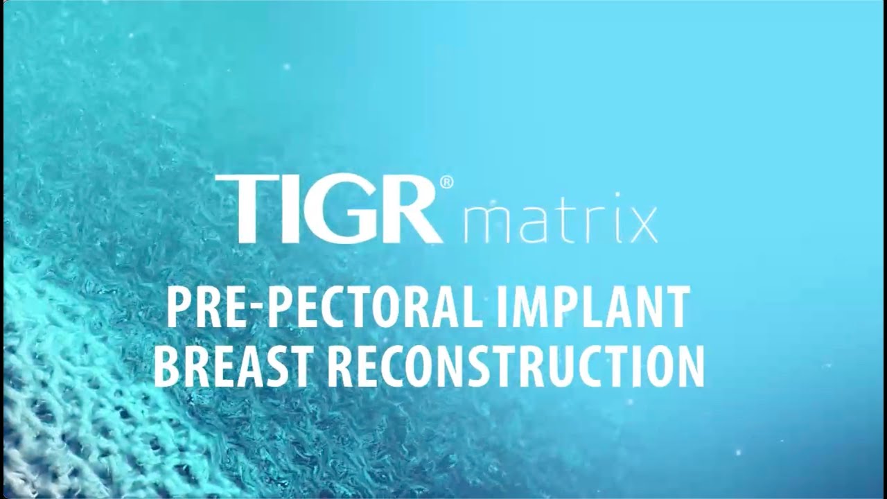 TIGR® Matrix Surgical Mesh Pre-pectoral Implant Breast Reconstruction ...