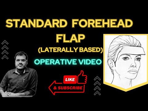 STANDARD FOREHEAD FLAP | HEAD AND NECK RECONSTRUCTION - YouTube