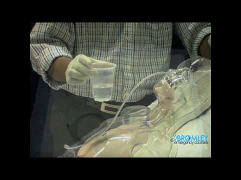 Placing a Nasogastric Tube procedure by Bromley Emergency Courses - YouTube