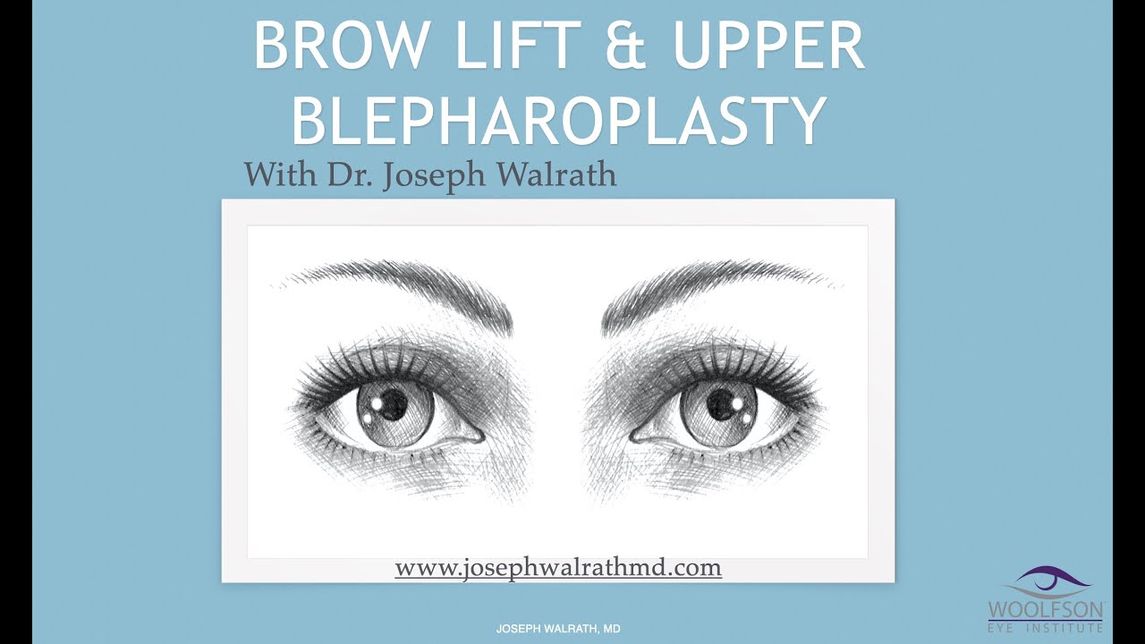 Upper Blepharoplasty and Brow Lift Surgery - YouTube