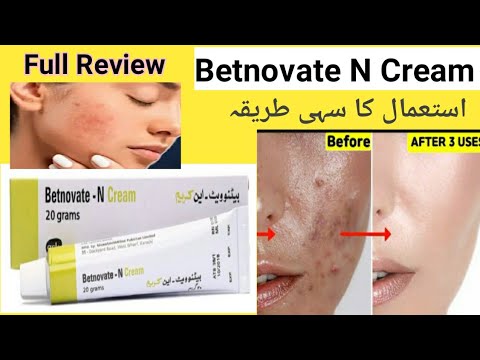How to Use Betnovate N Cream | Betnovate N Cream Complet Review ...