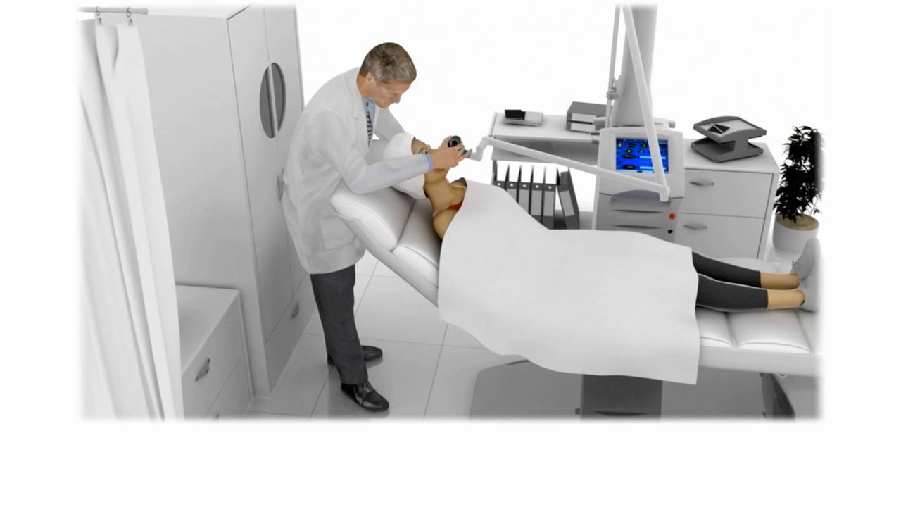 UltraPulse With SACCR FX Product Movie - YouTube