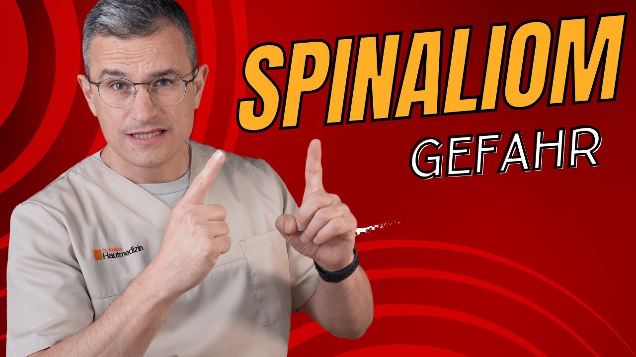 Spinaliom: Wie gefährlich ist dieses Plattenepithelkarzinom? 🧐🌞 - YouTube