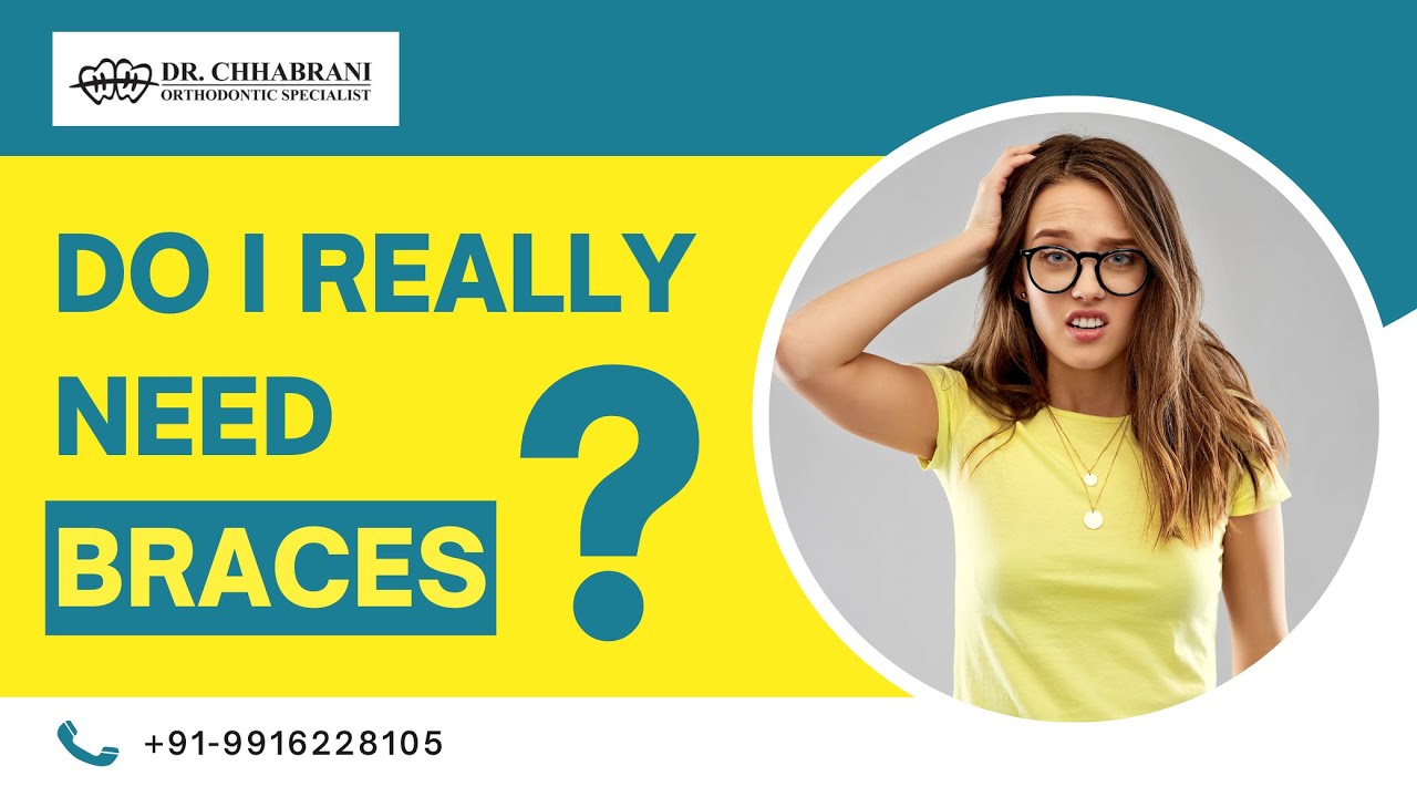 Do I really need Braces? - YouTube