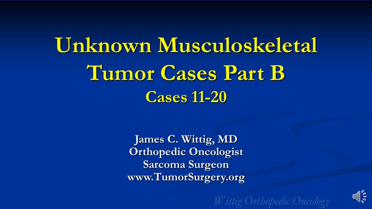 Orthopedic Oncology Course Unknown Test Cases Part B Cases 11 20 Orthopedic Oncology Course Unknown Test Cases Part B Cases 11 20
